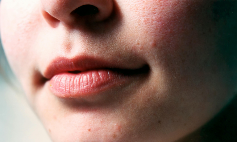 ¿Piel sensible? Una dermatóloga comparte sus mejores consejos